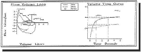 Flow Volume Curves No 1.