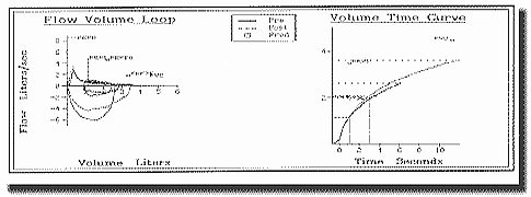 Flow Volume Curves No 1.