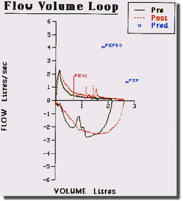 Flow Volume Curves No 1.