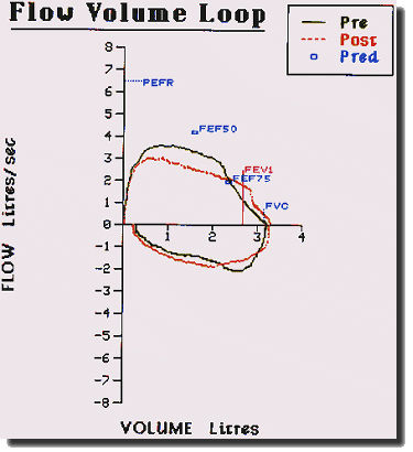 Flow Volume Curves No 1.