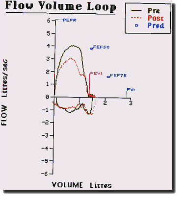 Flow Volume Curves No 1.